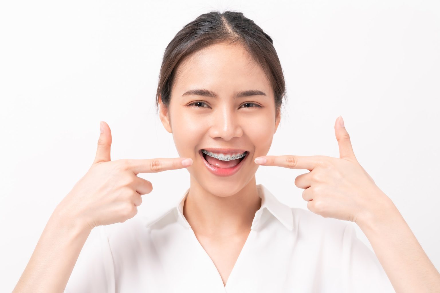 Orthodontiste définition - Comprendre l'orthodontie et les différents ...
